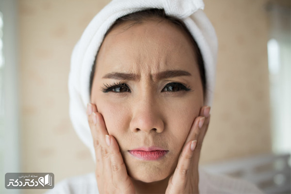 آکنه چیست؛ علت ایجاد و روشهای درمان آکنه و جوش صورت