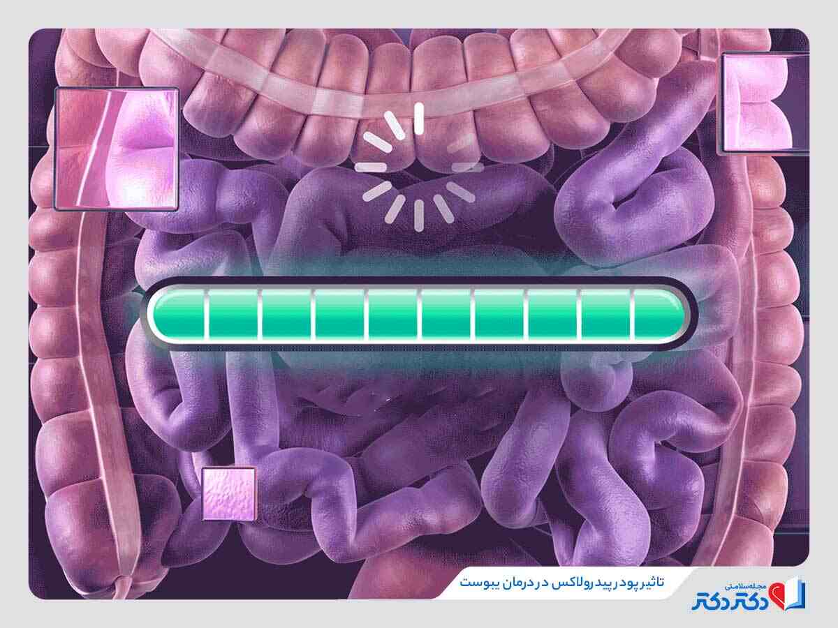 پودر پیدرولاکس چیست؟ کاربردهای آن برای درمان یبوست